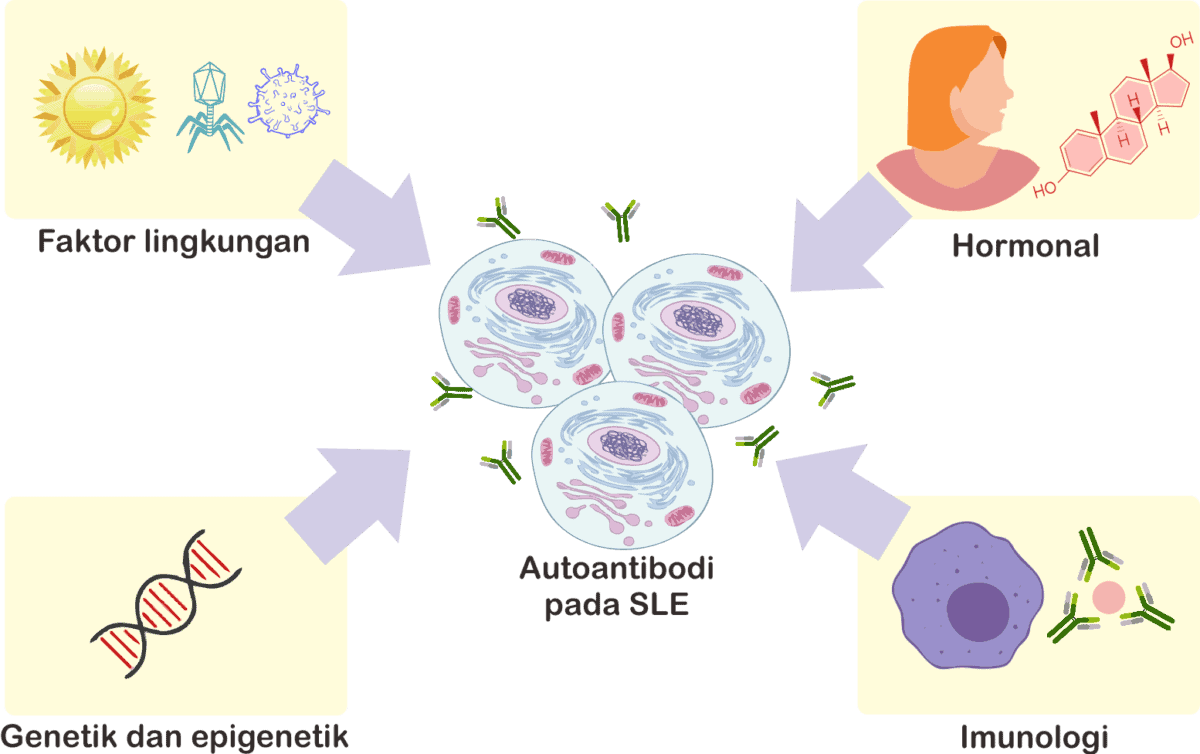 Patogenesis dan Patofisiologi SLE (Systemic Lupus Erythematosis ...