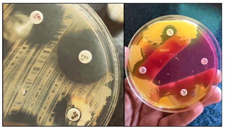 Infeksi MRSA (Methycillin-Resistant Staphylococcus aureus) – Kedokteran ...