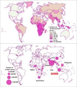 Tuberkulosis (TB): Patofisiologi, Diagnosis, & Tatalaksana – Kedokteran ...