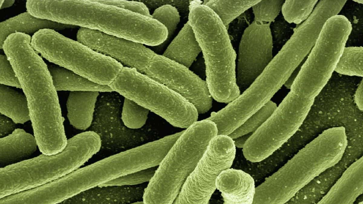 ESBL Extended Spectrum Beta Lactamase Kedokteran Caiherang
